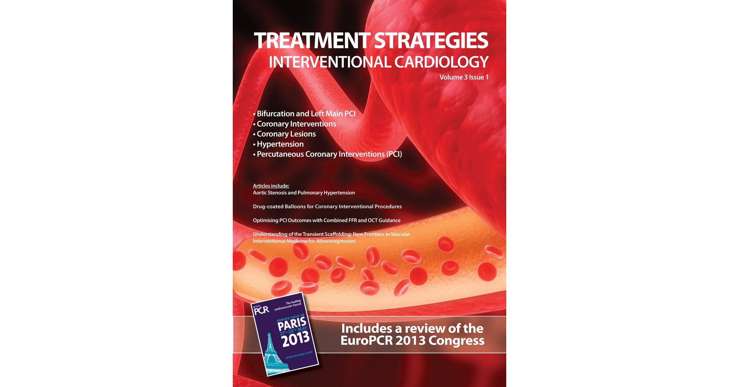 Treatment Strategies - Interventional Cardiology - Volume 3 Issue 1